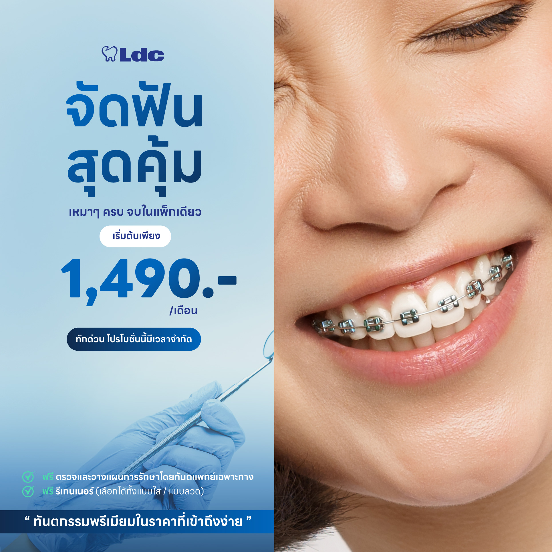 โปรจัดฟันสุดคุ้ม เหมาๆ ครบ จบในแพ็กเดียว ราคาเริ่มต้นเพียง 1,490 ...